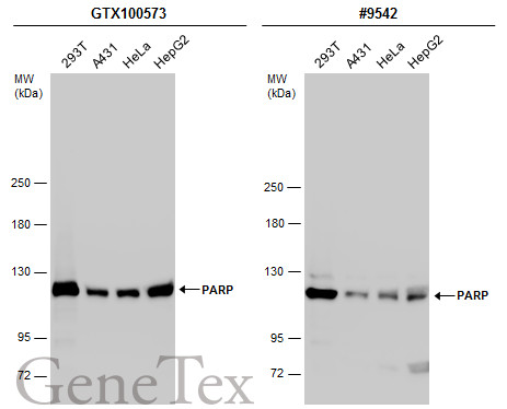 Anti-PARP antibody (GTX100573) | GeneTex