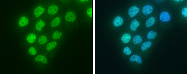Anti-BLM antibody [C3], C-term (GTX101303) | GeneTex