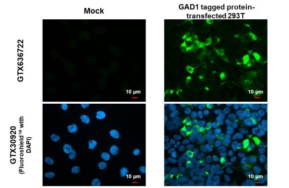 Anti-GAD67 antibody (GTX101881) | GeneTex