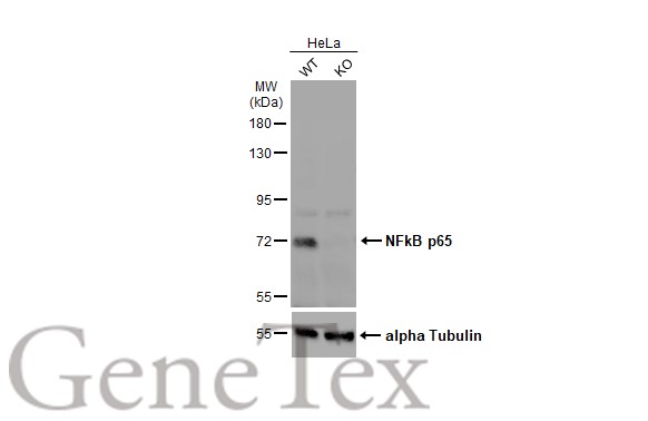 Anti-NFkB p65 antibody (GTX102090) | GeneTex