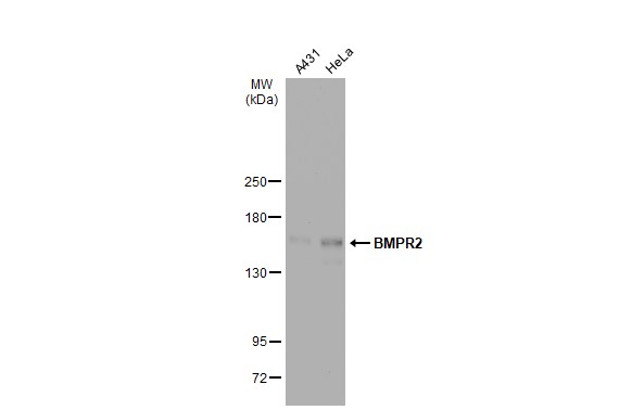 Anti-BMPR2 antibody [C1C3] (GTX102418) | GeneTex