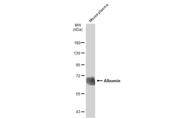 Anti-Albumin antibody (GTX102419) | GeneTex