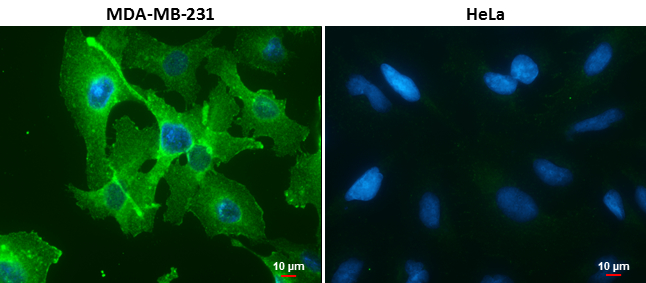 Anti-PD-L1 antibody (GTX104763) | GeneTex