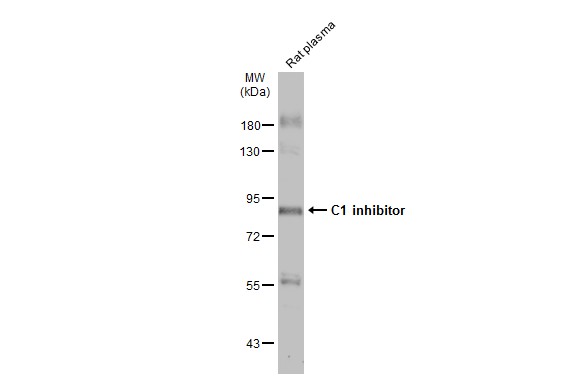 Anti-C1 inhibitor antibody [N1C3] (GTX105316) | GeneTex