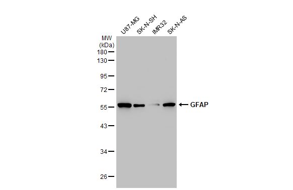 Anti-GFAP antibody (GTX108711) | GeneTex