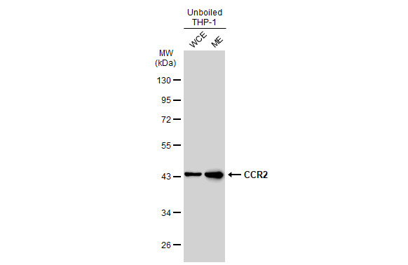 Anti-CCR2 antibody (GTX109684) | GeneTex