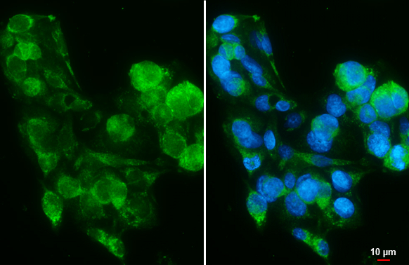 Anti-PIGR antibody [N2C1], Internal (GTX110197) | GeneTex
