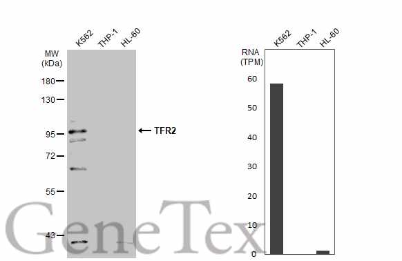 Anti-TFR2 antibody [N3C2], Internal (GTX110441) | GeneTex