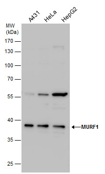 Anti-MURF1 antibody [N1], N-term (GTX110475) | GeneTex