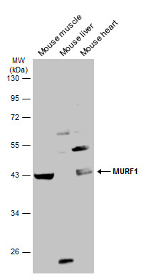 Anti-MURF1 antibody [N1], N-term (GTX110475) | GeneTex