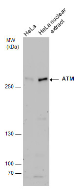 Anti-ATM antibody (GTX111106) | GeneTex