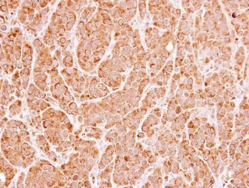 Anti-UNC13B antibody [N2N3] (GTX111244) | GeneTex