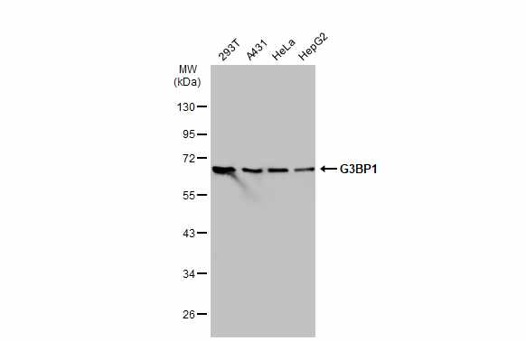 Anti-G3BP1 antibody (GTX112191) | GeneTex