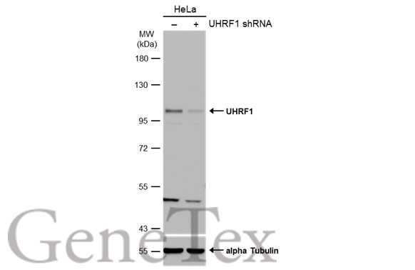 Anti-UHRF1 antibody (GTX113963) | GeneTex