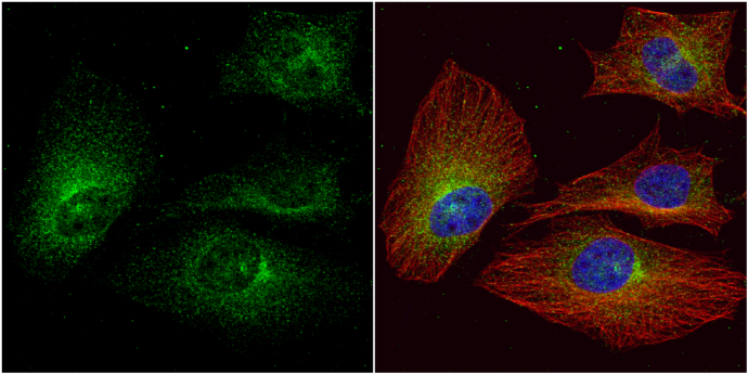 Anti-ALPPL2 antibody (GTX114250) | GeneTex
