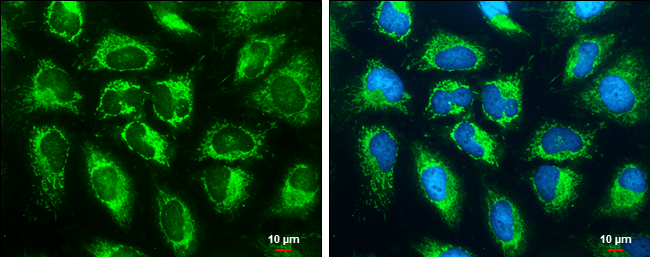 Anti-COX4 antibody (GTX114330) | GeneTex