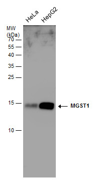 Anti-MGST1 antibody (GTX114551) | GeneTex
