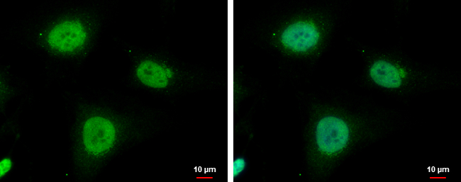 Anti-IMP3 antibody (GTX115459) | GeneTex