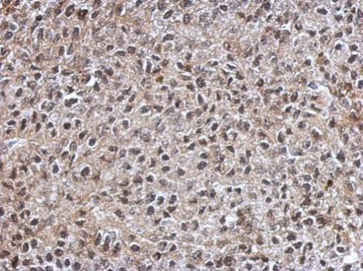 Anti-IMP3 antibody (GTX115459) | GeneTex