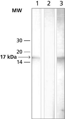 Anti-Histone H3K9ac (Acetyl Lys9) antibody (GTX12178) | GeneTex