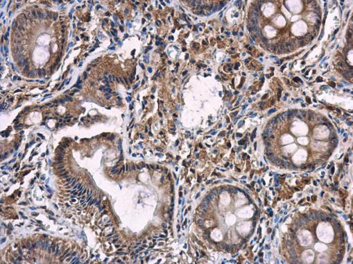 Anti-iNOS antibody [N1N2-2], N-term (GTX124210) | GeneTex