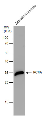 Anti-Pcna antibody (GTX124496) | GeneTex
