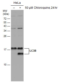 Anti-LC3B antibody (GTX127375) | GeneTex