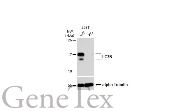 Anti-LC3B antibody (GTX127375) | GeneTex