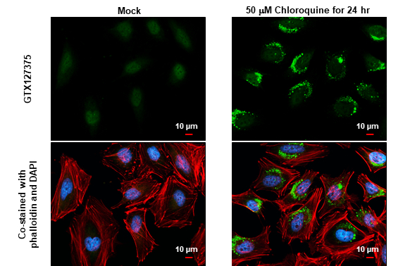 Anti-LC3B antibody (GTX127375) | GeneTex