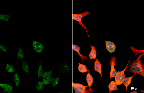 Anti-CEP152 antibody (GTX128027) | GeneTex