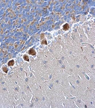 Anti-SQSTM1 / P62 (phospho Ser403) antibody (GTX128171) | GeneTex