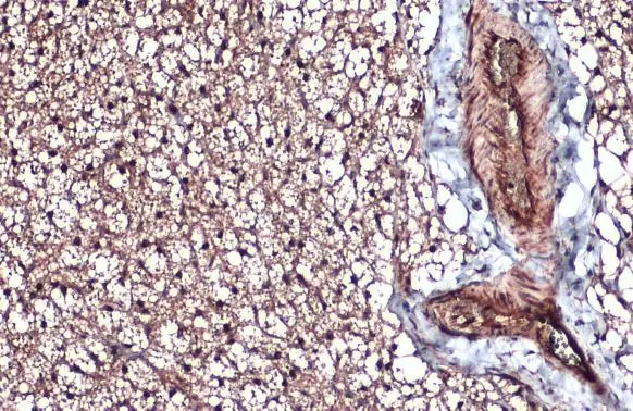 Anti-Integrin beta 1 / CD29 antibody (GTX128839) | GeneTex Anti-Integrin beta 1 / CD29 antibody (GTX128839) | GeneTex