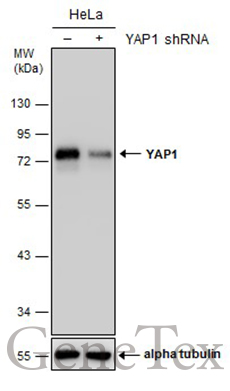 Anti-YAP1 antibody (GTX129151) | GeneTex