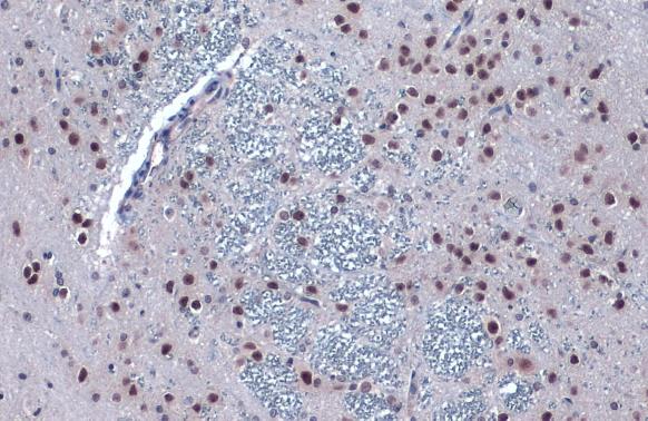 Anti-PERK antibody (GTX129275) | GeneTex