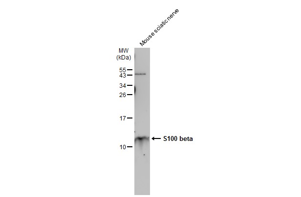 Anti-S100 beta antibody (GTX129573) | GeneTex