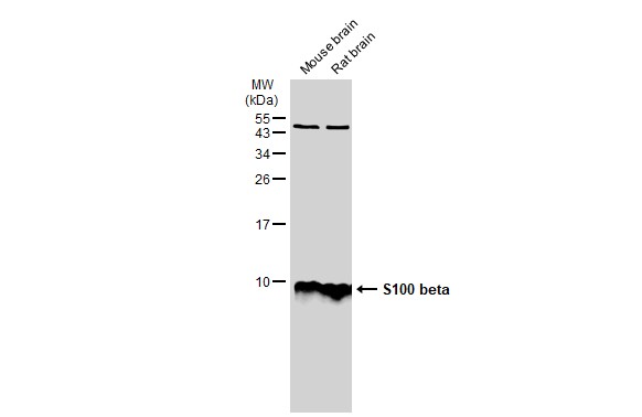 Anti-S100 beta antibody (GTX129573) | GeneTex