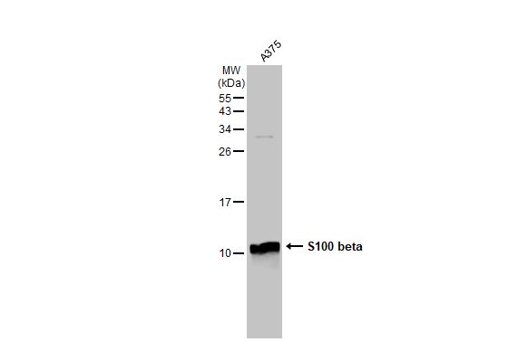 Anti-S100 beta antibody (GTX129573) | GeneTex