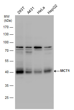 Anti-MCT1 antibody (GTX129599) | GeneTex