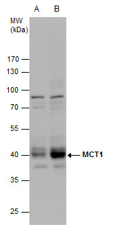 Anti-MCT1 antibody (GTX129599) | GeneTex