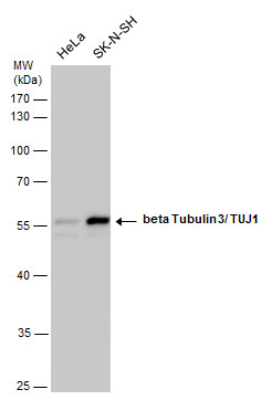Anti-beta Tubulin 3/ Tuj1 antibody (GTX129913) | GeneTex