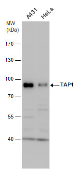 Anti-TAP1 antibody (GTX129963) | GeneTex