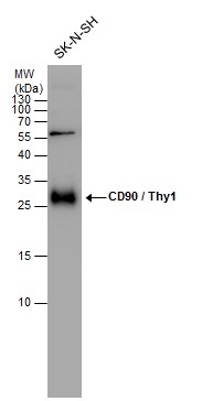 Anti-CD90 antibody (GTX130047) | GeneTex
