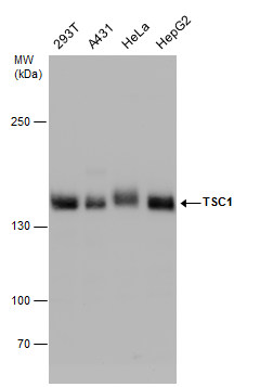 Anti-Hamartin / TSC1 antibody (GTX130062) | GeneTex