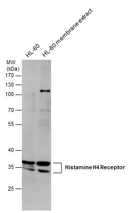 Anti-Histamine H4 Receptor antibody (GTX130116) | GeneTex