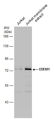 Anti-EDEM1 antibody (GTX130500) | GeneTex