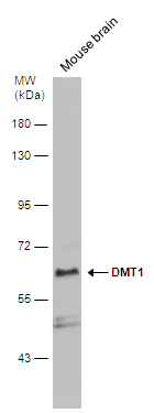 Anti-DMT1 antibody (GTX130889) | GeneTex