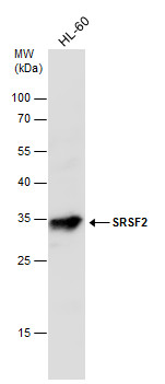 Anti-SC35 antibody (GTX130950) | GeneTex