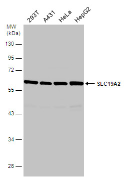 Anti-SLC19A2 antibody (GTX131042) | GeneTex