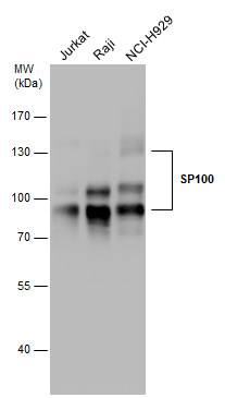 Anti-SP100 antibody (GTX131569) | GeneTex