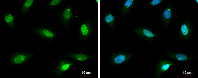 Anti-SP100 antibody (GTX131570) | GeneTex